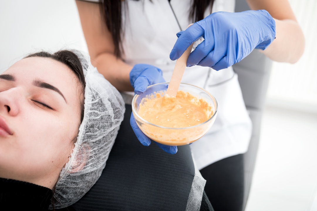 How Chemical Peels Transform Dull, Sun-Damaged Skin in Just One ...