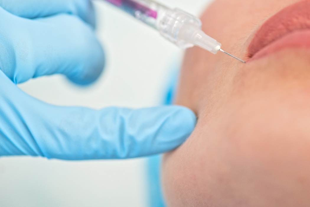 Your First Filler Appointment: What to Expect at Every Step